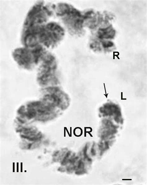 Polytene Chromosome Iii With Nucleolar Organizer Region Nor And Dark