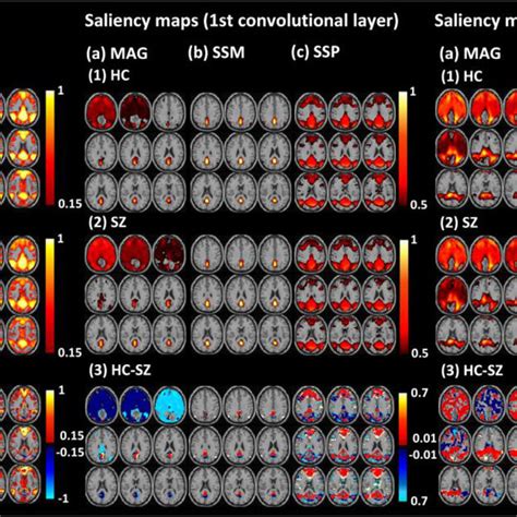 Comparison Of Dmn Saliency Maps At The First And Second Convolutional