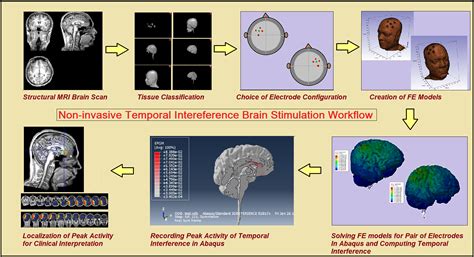 Non Invasive Temporal Interference Brain Stimulation 3dexperience Edu