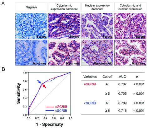 Immunohistochemical Expression Of Scrib And Statistical Analysis A