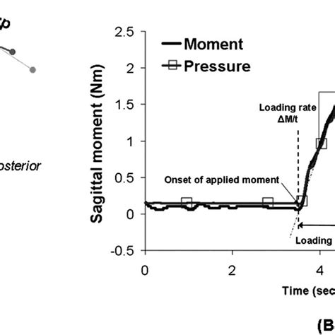 gender dependent facet joint shear motion in the lower cervical spine