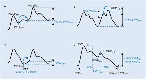 8 In The Beginning Disturbed Pulse Waveforms And The Corresponding