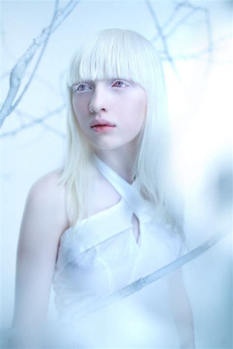 Pin On The Beauty Of Albinism
