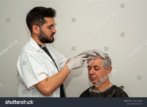The Ultimate Guide To Hair Transplants What You Need To Know Uk Hair