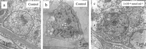 Transmission Electron Micrographs Showing The Testicular Tissue