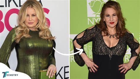 Jennifer Coolidge Plastic Surgery Before And After Photos