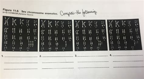 solved figure 11 6 sex chromosome anomalies a c ocnr s