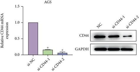 Mir 328 3p Worked As A Cancer Suppressor In Stad Via Targeting Cd44 To