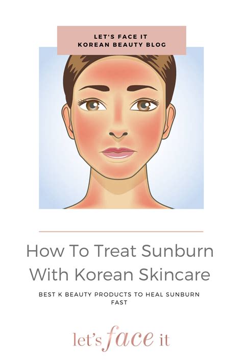 How To Treat Sunburn With Korean Skincare Hacks Lets Face It