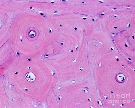 Lamellar Bone Histology
