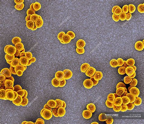 Methicillin Resistant Staphylococcus Aureus — Antibiotic Resistant