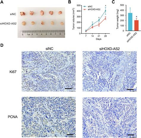 Knockdown Of Hoxd As2 Suppresses Hcc Growth In Subcutaneous Xenograft