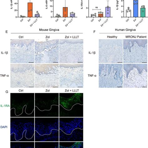 Lllt Inhibited Pro Inflammation Cytokines Increased Il 1ra Expression