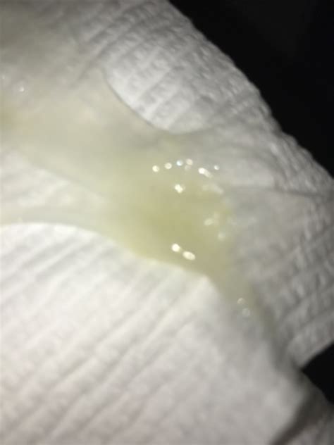 What Color Is Discharge On A Panty Liner At Lia Hall Blog