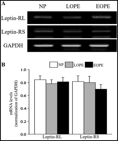 Leptin Leptin Receptors And Hypoxia Induced Factor 1α Expression In