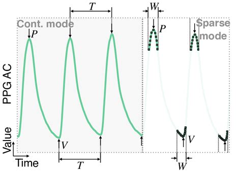 Shows A Typical Ppg Waveform Containing Both Ac And Dc Components The