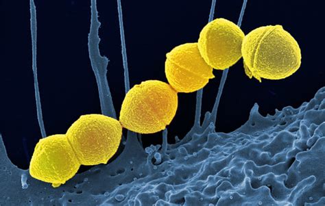 Streptococcus Pyogenes Group A Strep Colorized Scanning … Flickr