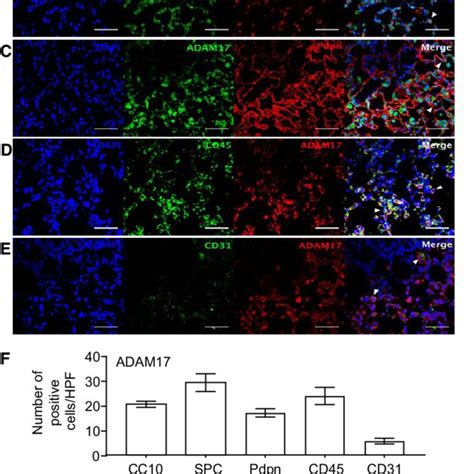 Cellular Expression Pattern Of Adam17 In Lungs Of Tumor Bearing Mice