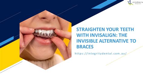 Ppt Straighten Your Teeth With Invisalign The Invisible Alternative