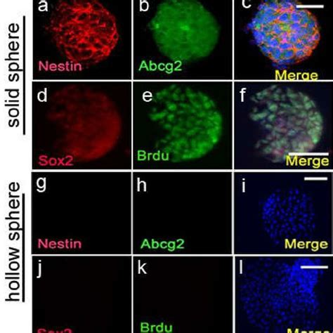 Expression Of Stem Cell Markers By Solid Sphere Cells And Their