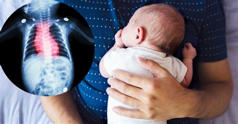 Cardiopatías Congénitas En Bebés Por Qué Se Forman Y Cómo Tratarlas