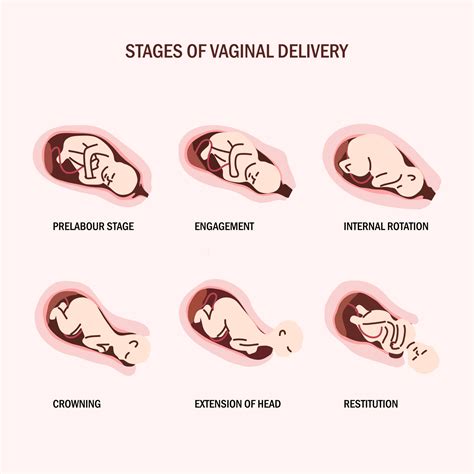 Stage Of Vaginal Delivery Flat Illustration 7874049 Vector Art At Vecteezy