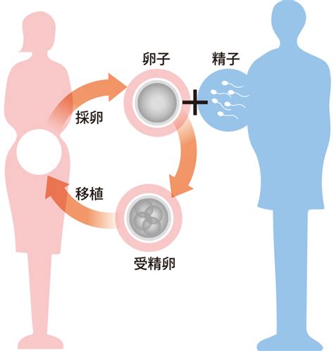 高度生殖補助医療 不妊治療 高度生殖医療専門 仙台artクリニック