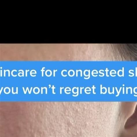Lindsey Zubritsky Md Faad On Instagram What Is Congested Skin 👉