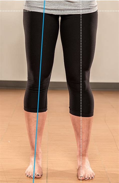 Posture Power How To Correct Your Bodys Alignment