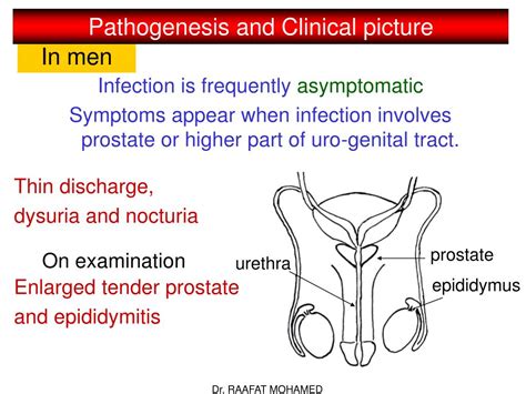Ppt Trichomonas Vaginalis Powerpoint Presentation Free Download Id