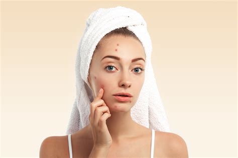 What Is The Best Skincare For Adult Acne Thrifty Momma Ramblings