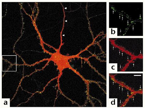 Continual Remodeling Of Postsynaptic Density And Its Regulation By