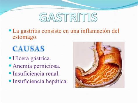 Las 15 Enfermedades Del Aparato Digestivo M 225 S Comunes Gambaran
