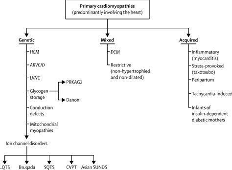 Dilated Cardiomyopathy The Lancet