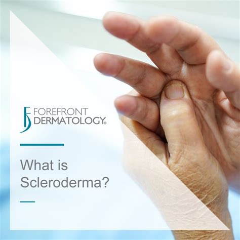 What Is Scleroderma Forefront Dermatology