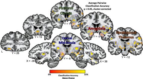 Multivariate Pattern Analyses Decode Taste Quality Within Brain Regions