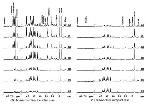 Typical 1 H Nmr Spectra Of Serum Cpmg Pulse Sequence Of A