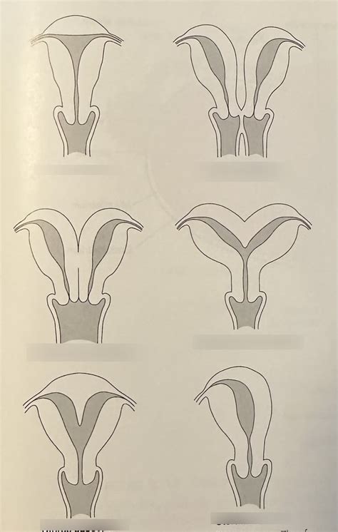 Uterine Positions Diagram Quizlet