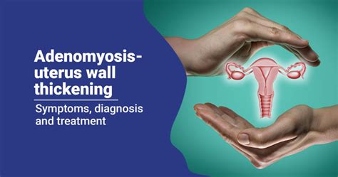 Adenomyosis Symptoms Diagnosis And Treatment