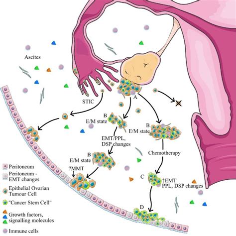 Metastatic Dissemination Of Ovarian Cancer Requires Dynamic And
