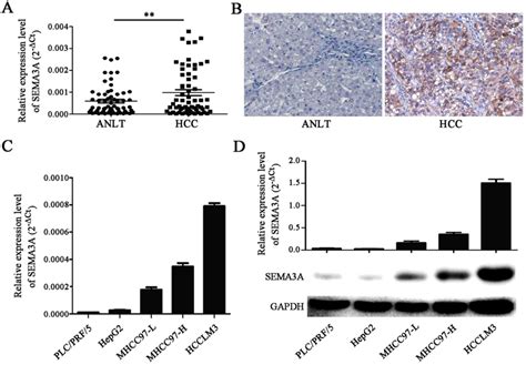 Novel Role Of Semaphorin 3a In The Growth And Progression Of