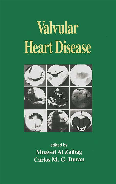 Amazon Valvular Heart Disease Fundamental And Clinical Cardiology