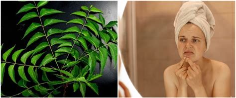 11 Manfaat Daun Neem Untuk Kecantikan Wajah Bebas Jerawat