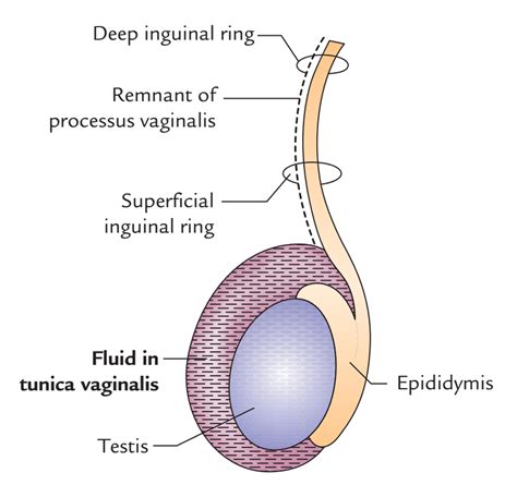Easy Notes On 【testis And Epididymis】learn In Just 3 Minutes