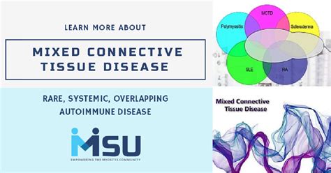 Mixed Connective Tissue Disease Mctd Myositis Support And Understanding