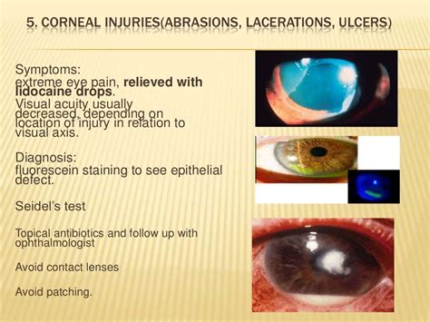Common Ocular Emergencies