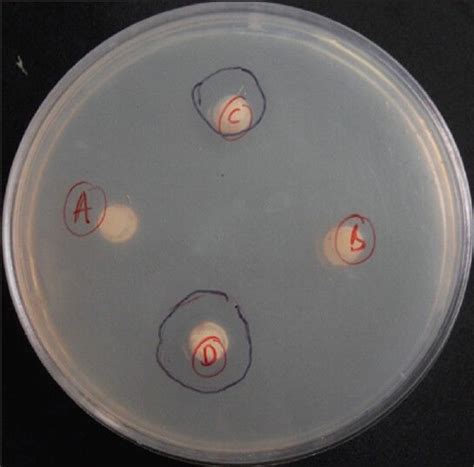Agar Plate Showing Zones Of Inhibition Around Groups 3 And 4 Download