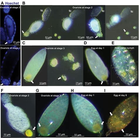 Patterns Of Host Cell Inheritance In The Bacterial Symbiosis Of