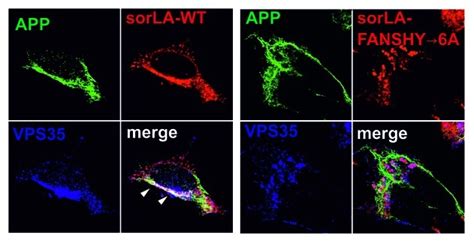 Sorla Is A Molecular Link For Retromer Dependent Sorting Of The Amyloid