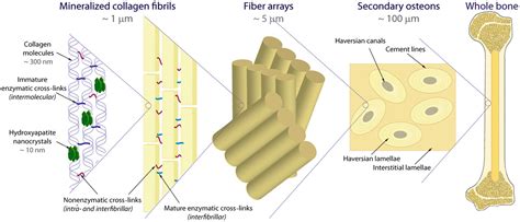 The Brittleness Of Aging Bones More Than A Loss Of Bone Mass